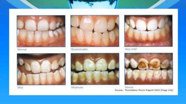 Enamel composition and structure