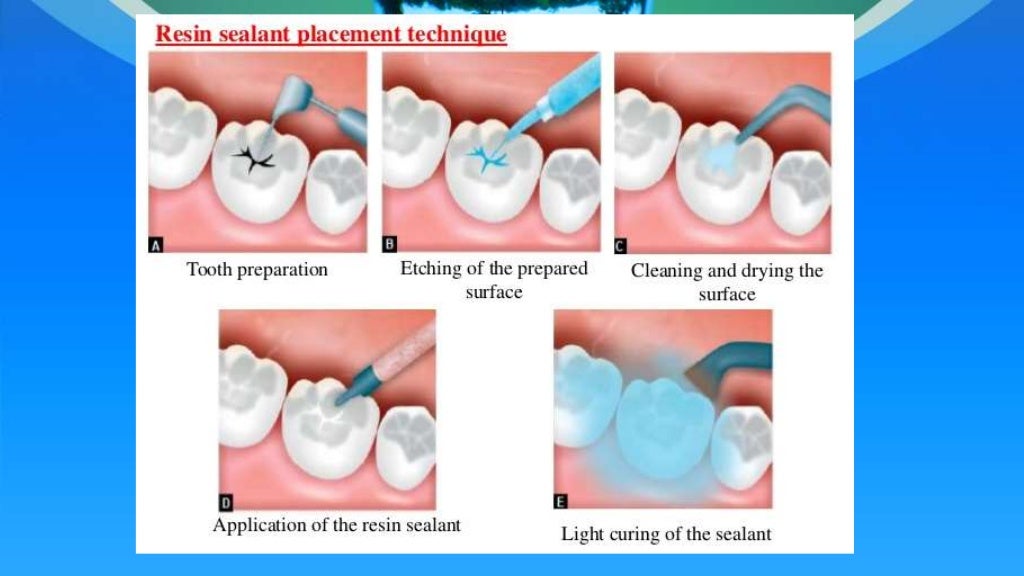 Enamel composition and structure