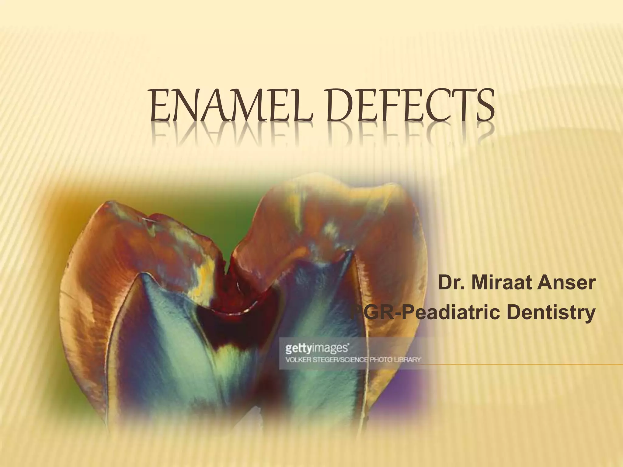 Enamel defects | PPTX