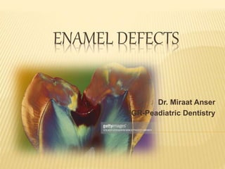 Enamel defects | PPTX