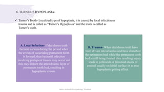 Enamel defects | PDF