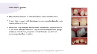 Enamel defects | PDF