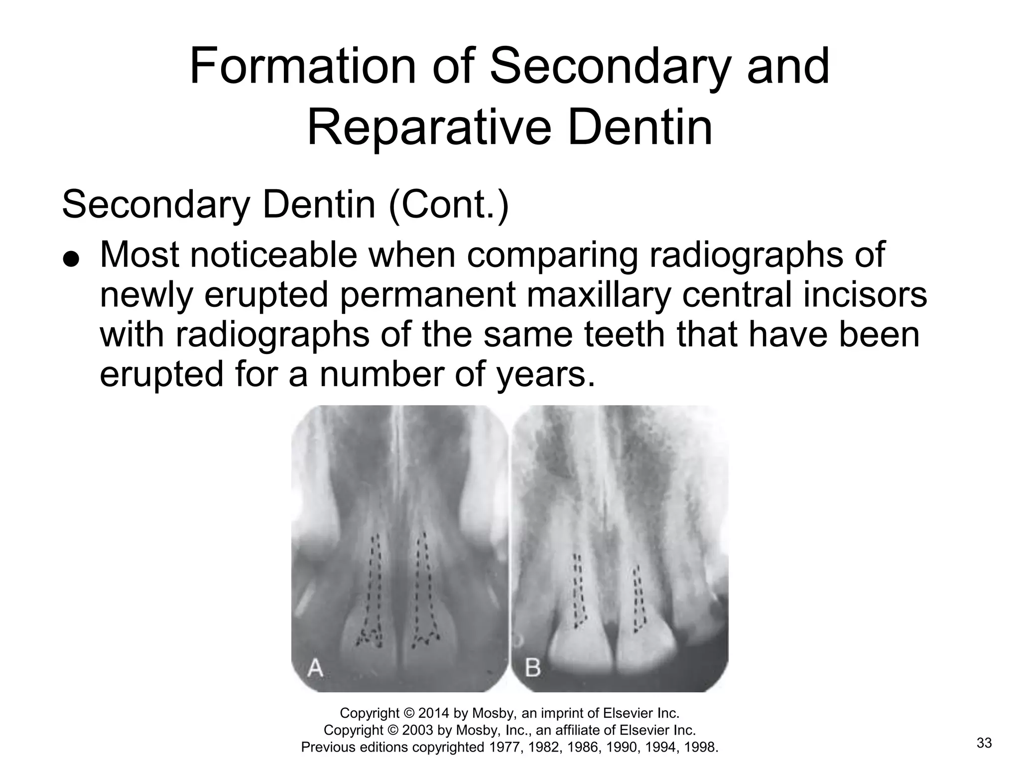 Oral Anatomy: Enamel, dentin, and pulp | PPTX