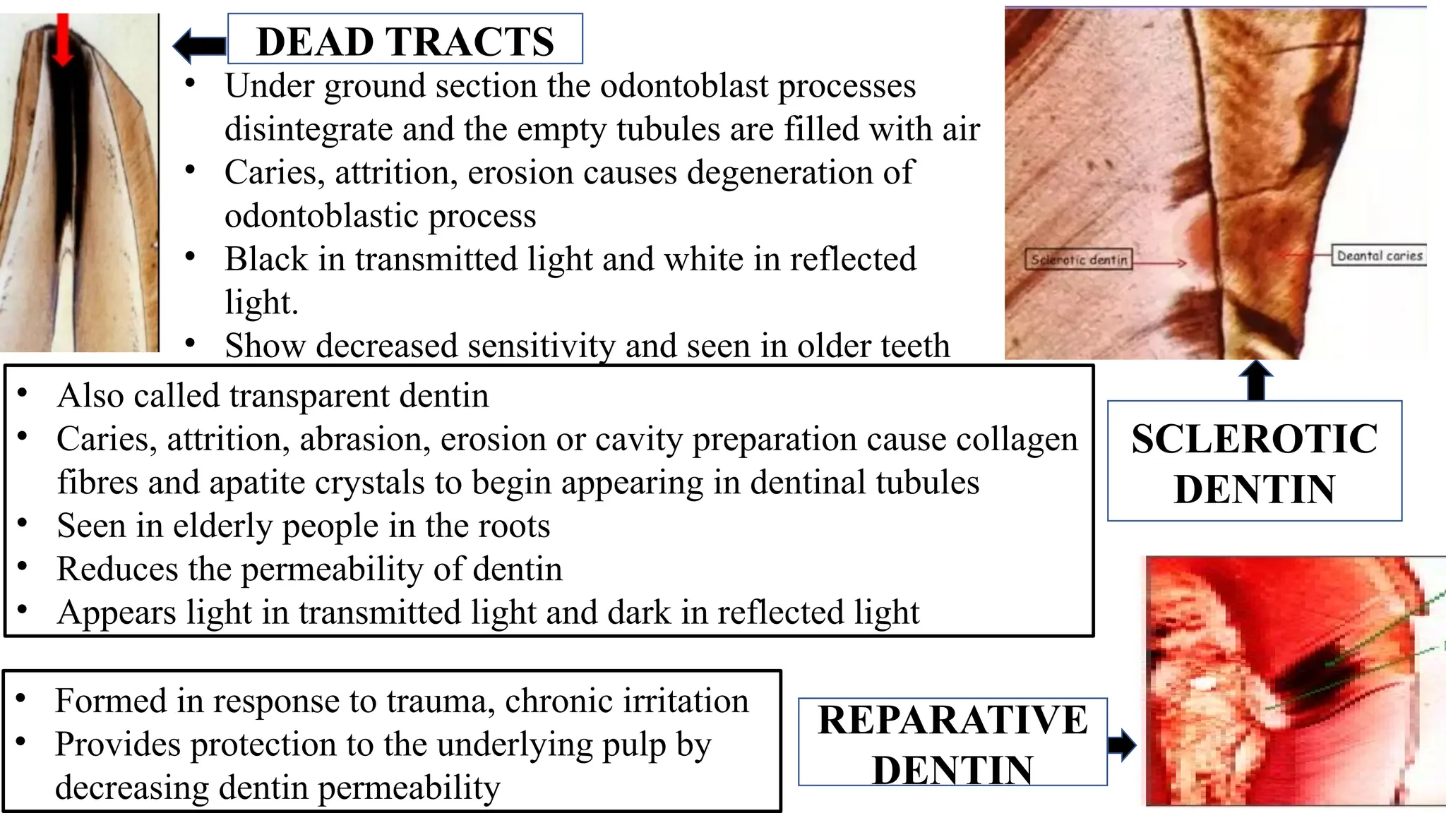 ENAMEL,DENTIN,PULP,CEMENTUM AND PDL,PDL.pptx