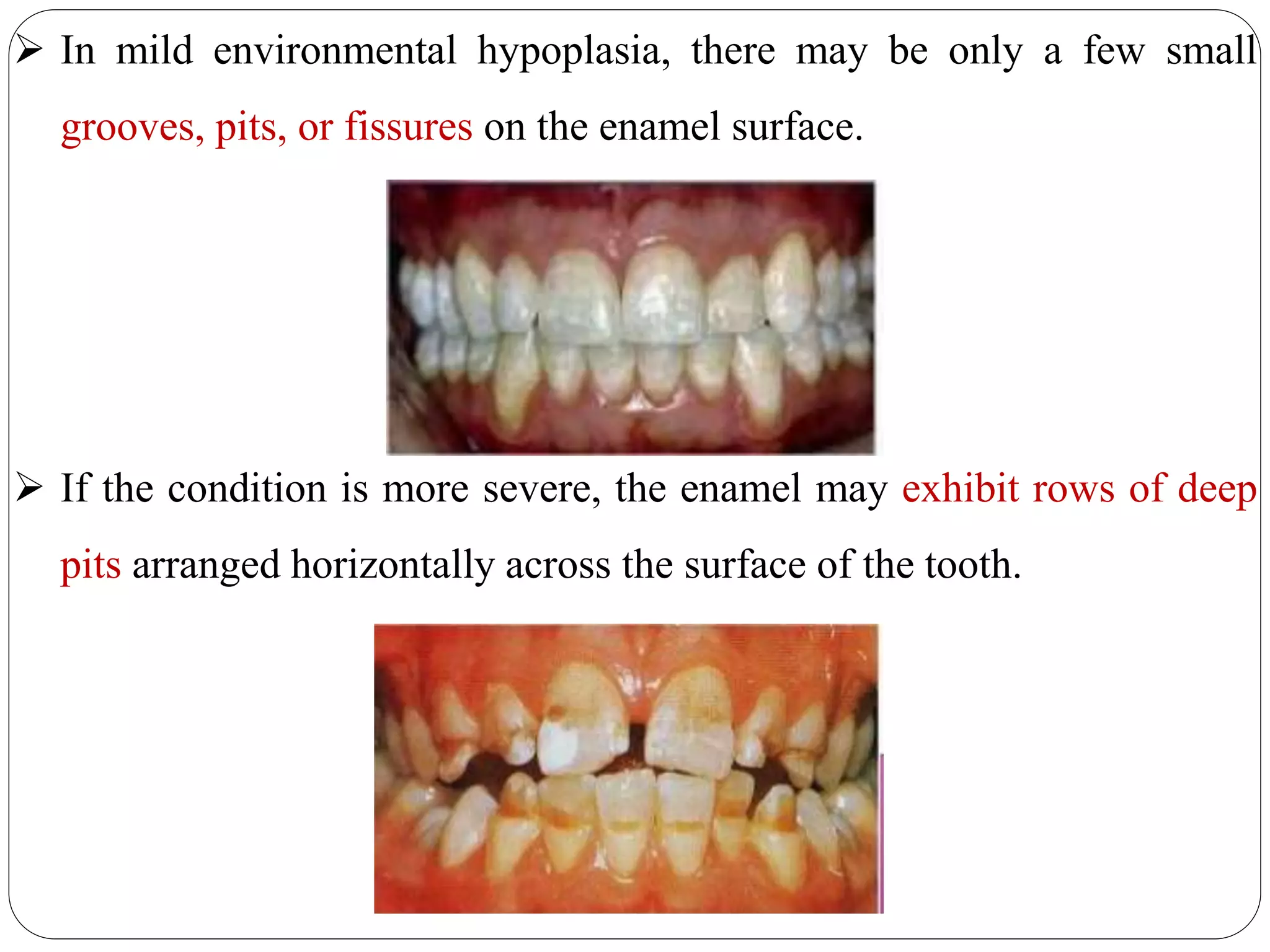 Enamel | PPTX