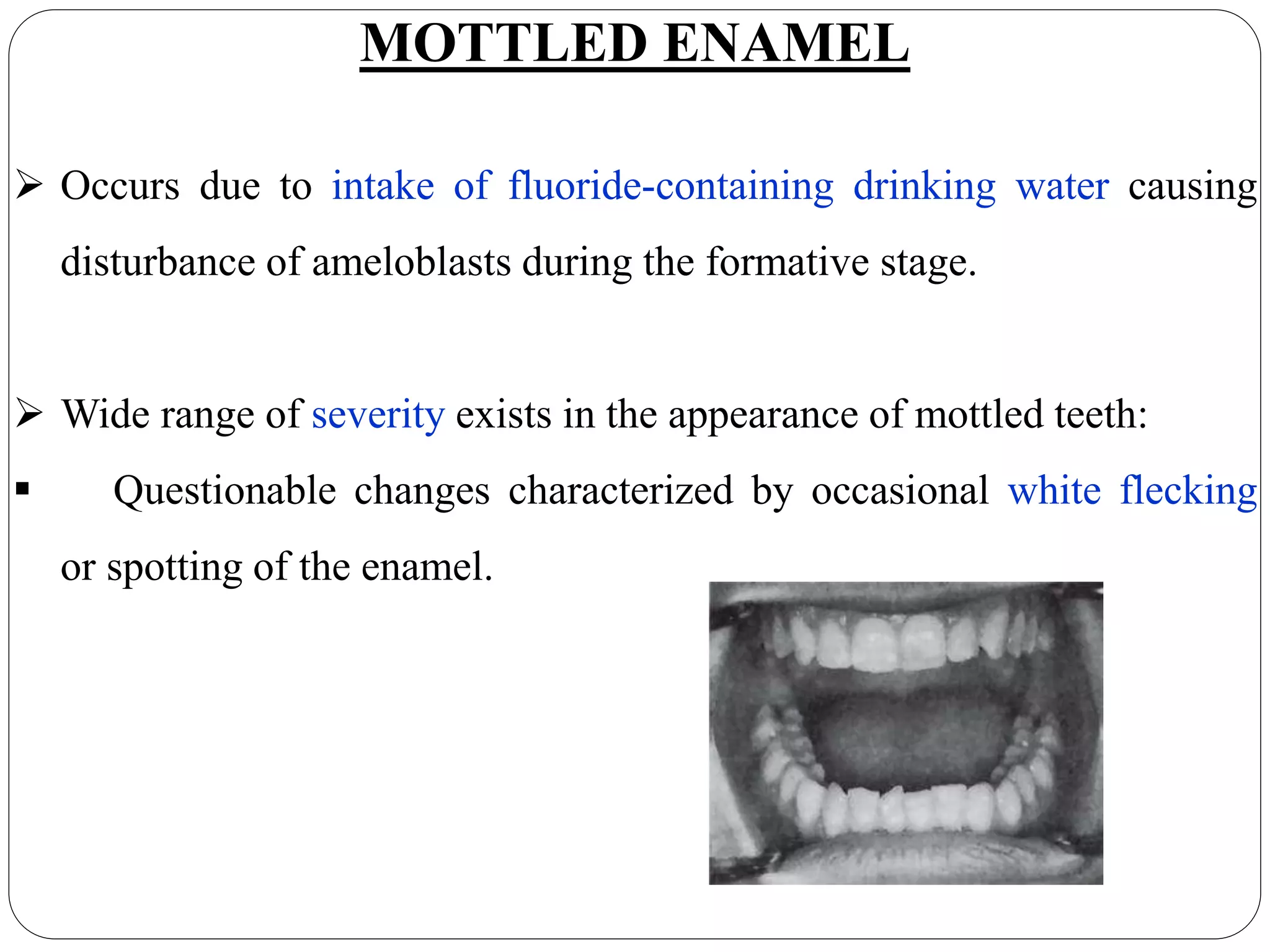 Enamel | PPTX