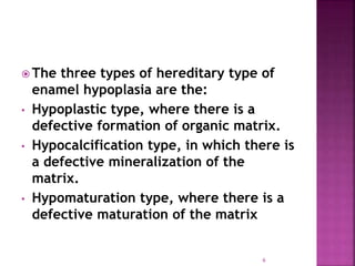 Enamel hypoplasia ppt | PPTX