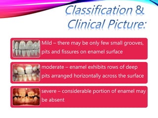 Enamel hypoplasia | PPTX