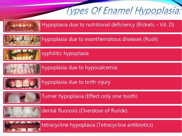 Enamel hypoplasia