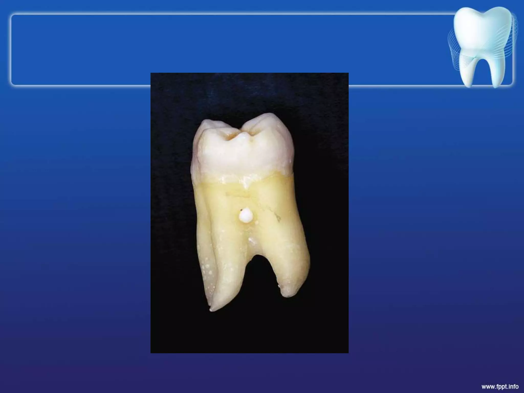 Enamel pearl | PPTX