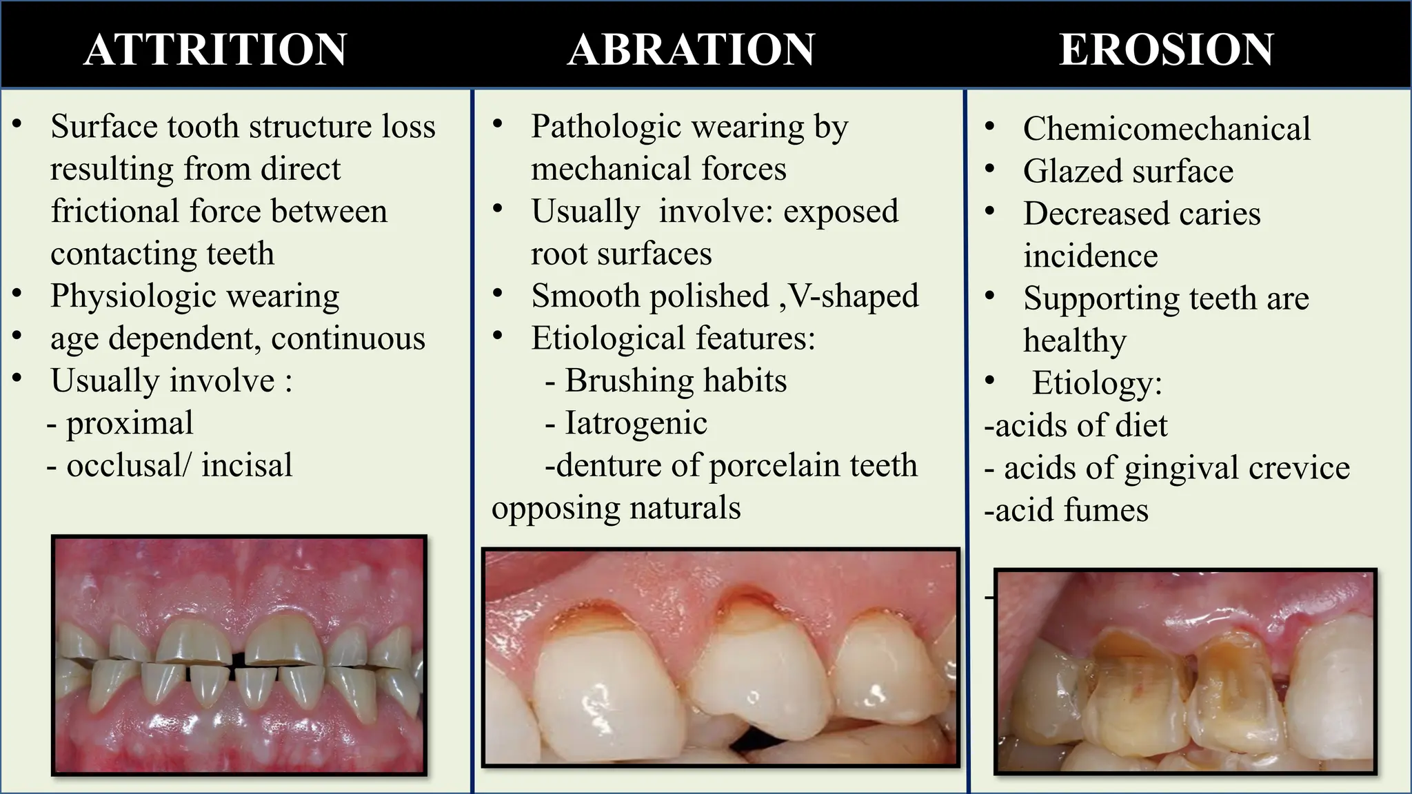 Enamel Seminar - Anu presented.pptx...... | PPTX