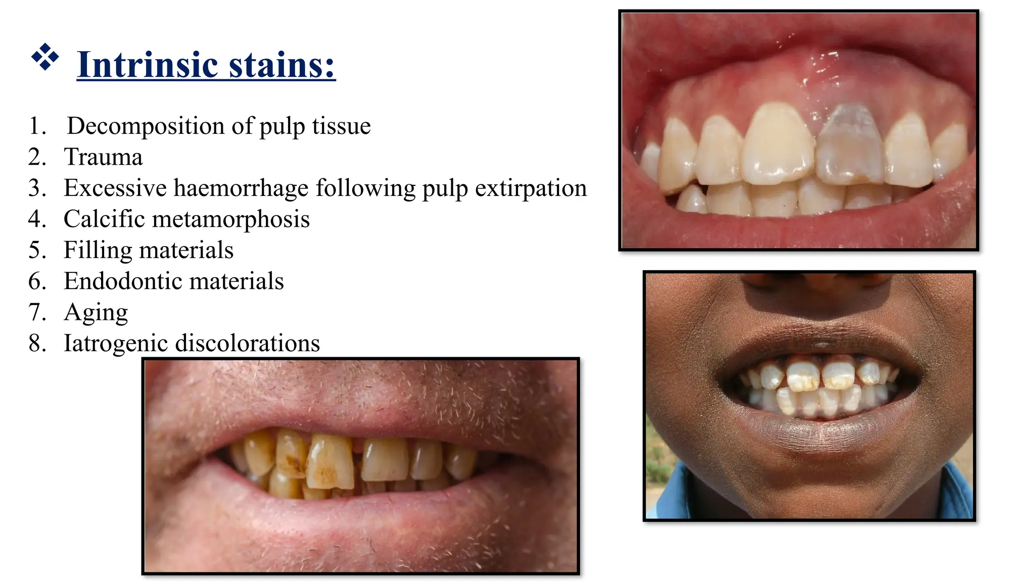 Enamel Seminar - Anu presented.pptx...... | PPTX