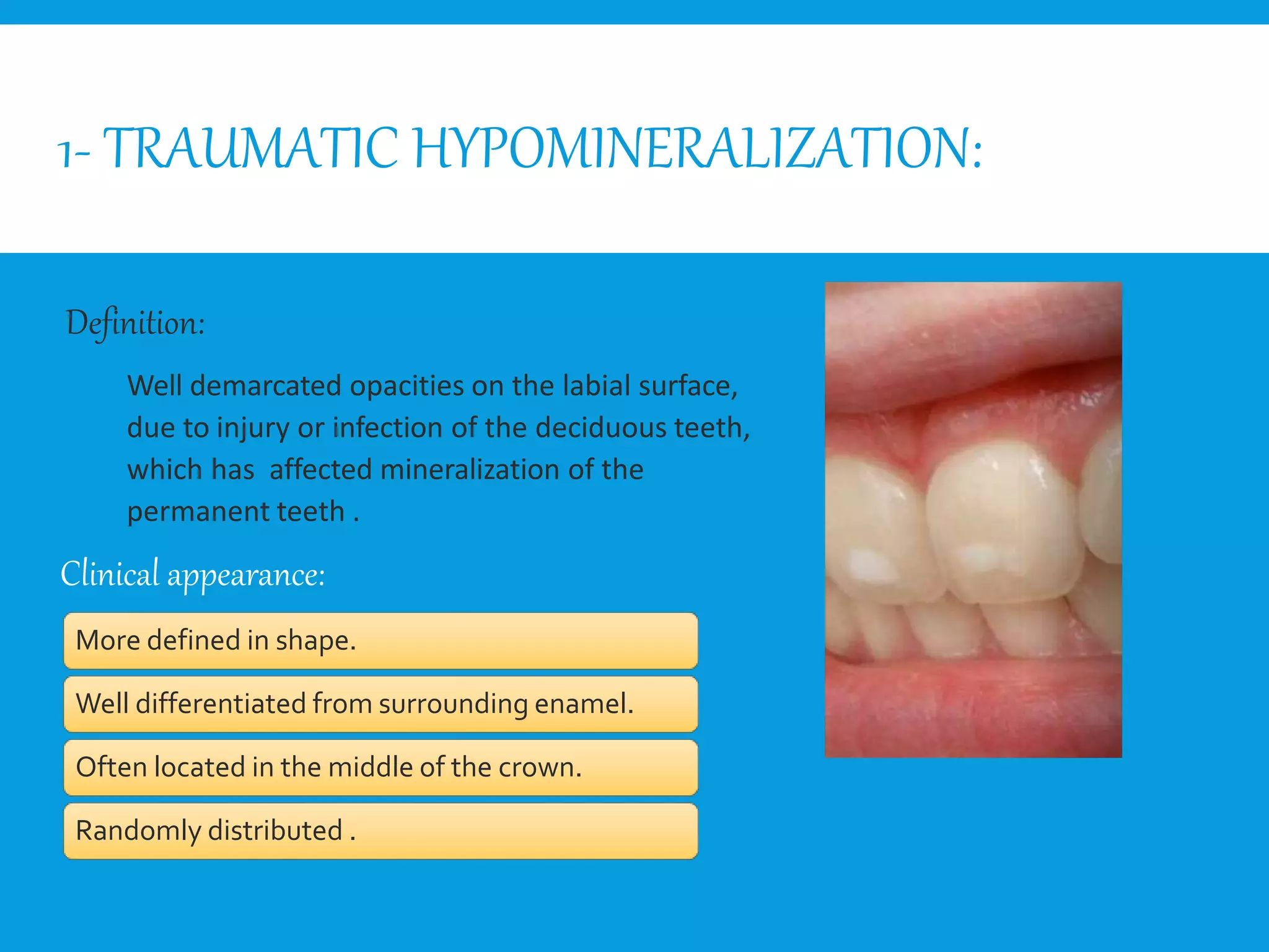 Enamel white lesions | PPTX
