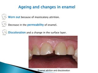 Enamle | PPT