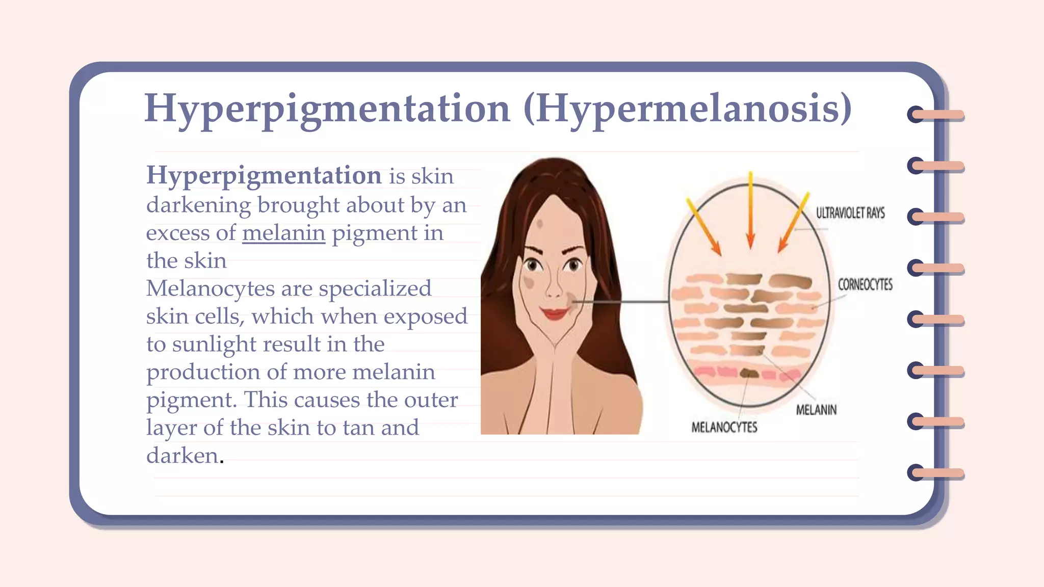Skin pigmentation | PPTX