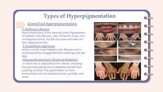 Skin pigmentation | PPTX