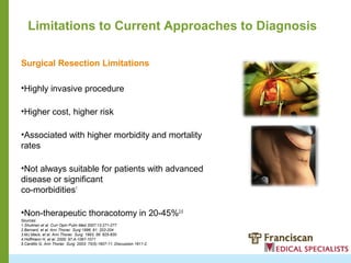 Electromagnetic Navigation Bronchoscopy (ENB): Clinical Review | PPT
