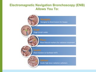 Electromagnetic Navigation Bronchoscopy (ENB): Clinical Review | PPT