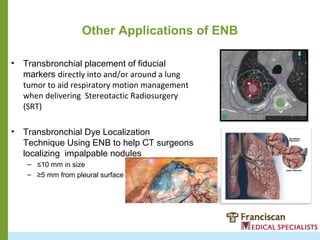 Electromagnetic Navigation Bronchoscopy (ENB): Clinical Review | PPT