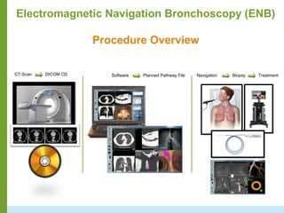 Electromagnetic Navigation Bronchoscopy (ENB): Clinical Review | PPT