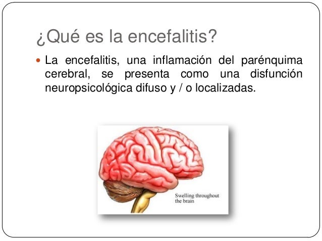 Encefalitis: Qué Es, Síntomas, Tratamientos E Información – EYCURB