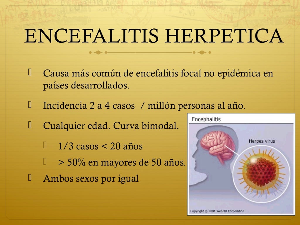 Encefalitis Infecciosas Del Adulto. – FDOMF