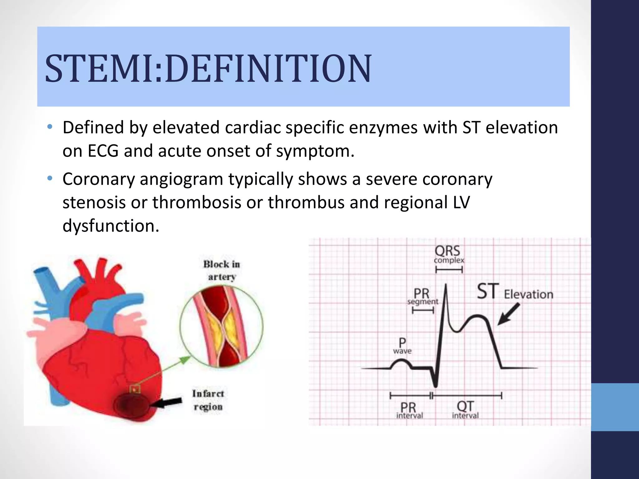 Acute coronary syndrome | PPTX