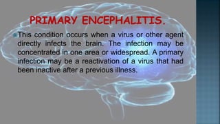 Encephalitis | PPTX