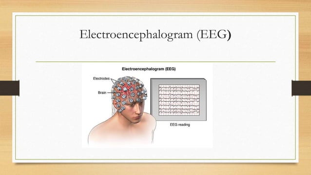 Encephalitis | PPTX | Physical Therapy | Wellness
