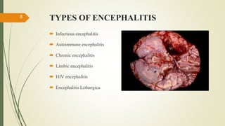 Encephalitis - A deadly infection | PPTX