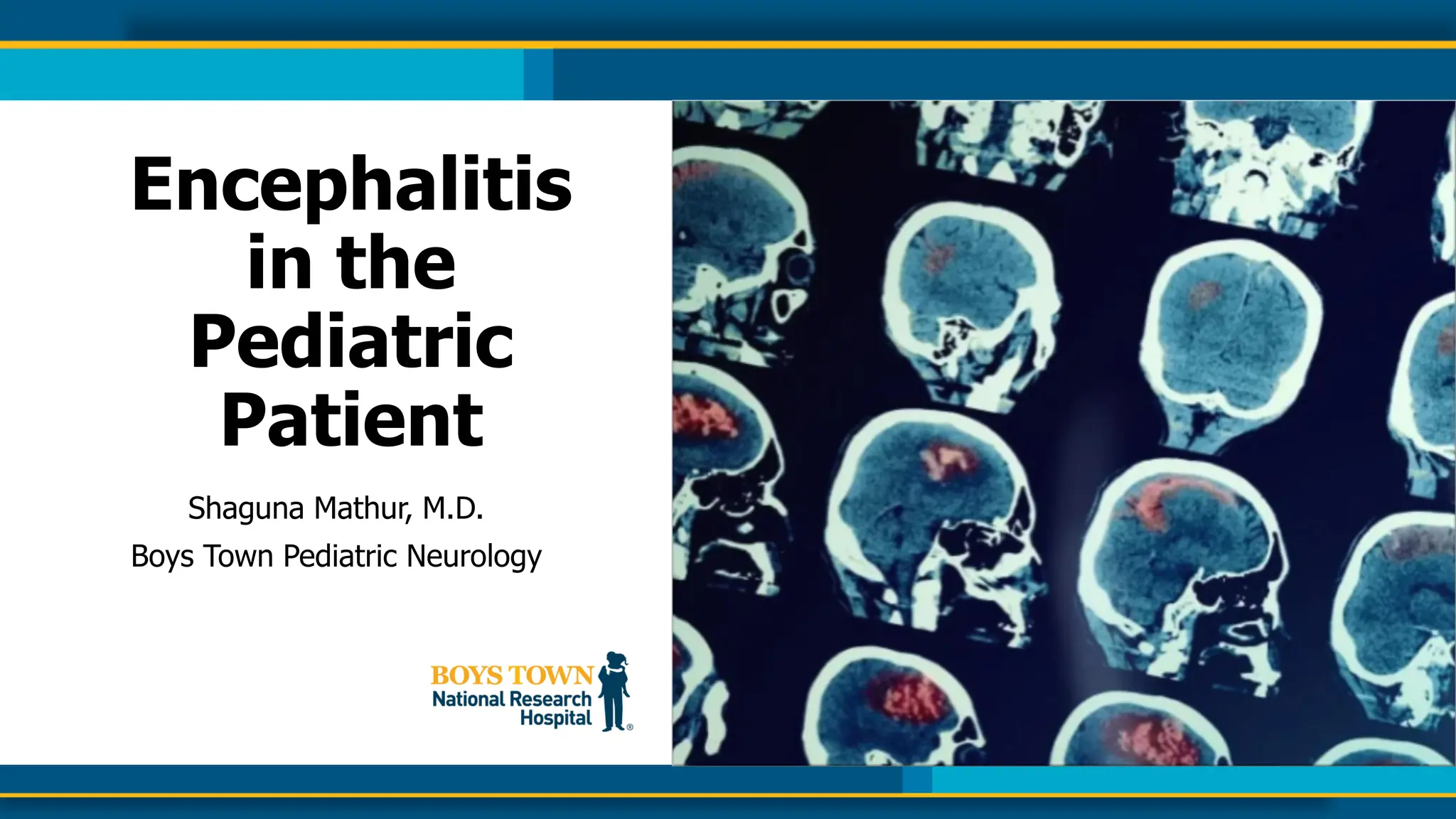 Encephalitis-in- infant Pediatric-Patients.pdf