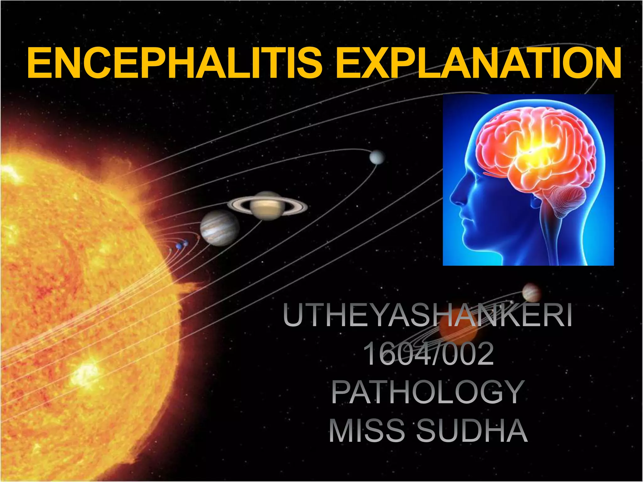 Encephalitis explanation | PPTX