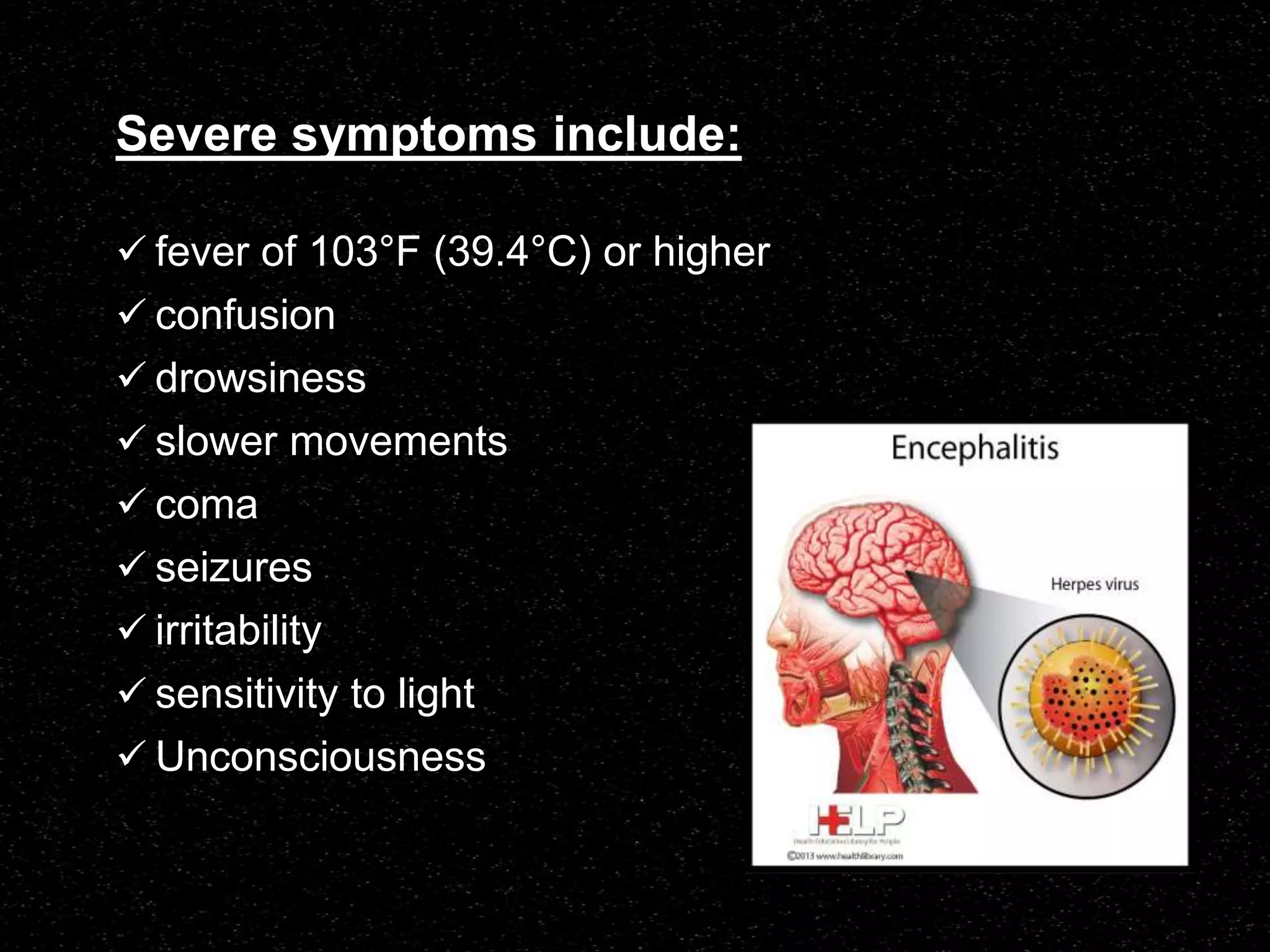 Encephalitis explanation | PPTX