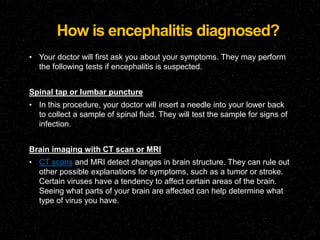Encephalitis explanation | PPTX