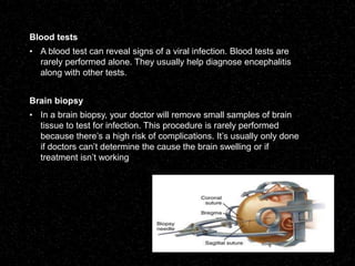 Encephalitis explanation | PPTX