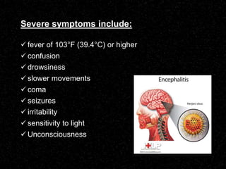 Encephalitis explanation | PPTX