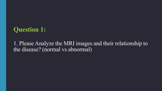 Encephalitis, analyzing MRI and treatment of intractable epilepsy | PPT