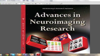 ENCEPHALOGRAPHY PANKAJ.pptx