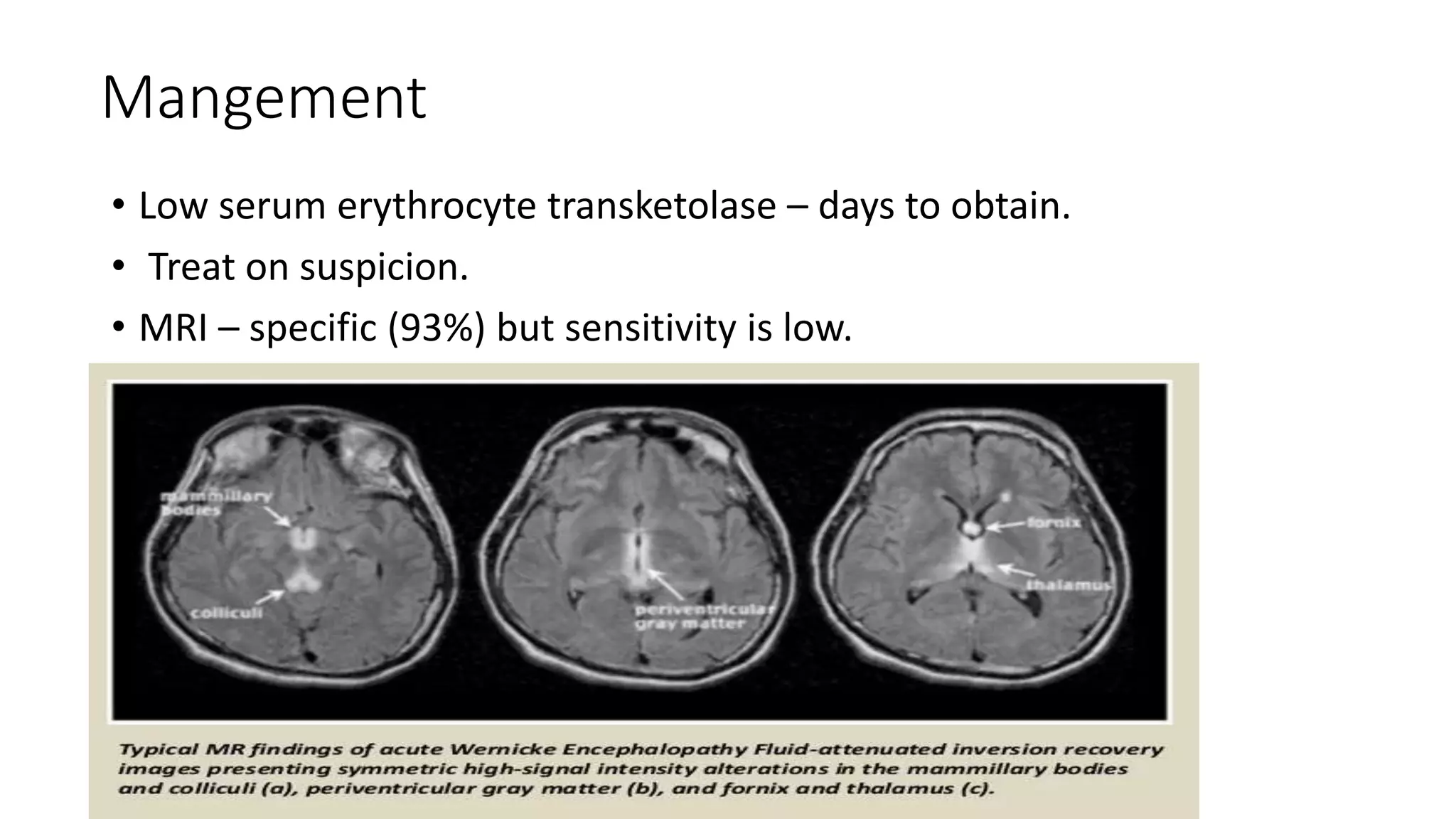 ENCEPHALOPATHY | PPTX