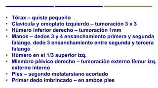Encondromatosis | PPTX