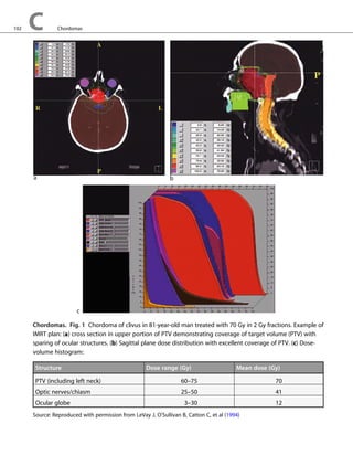 Encyclopedia of radiation oncology | PDF