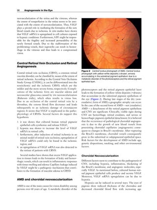 Encyclopedia of the_eye,_four-volume_set | PDF