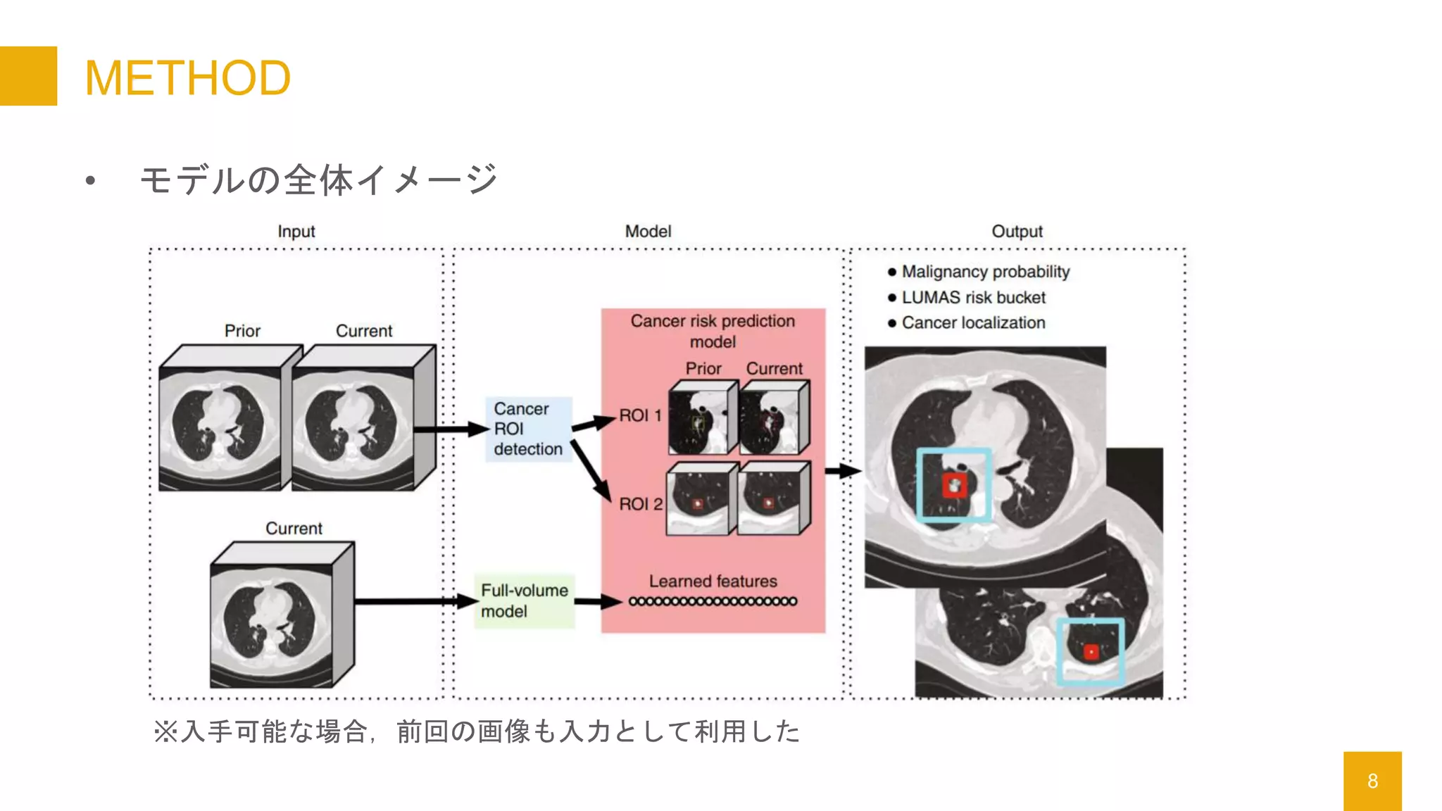 End to-end lung cancer screening with three-dimensional deep learning ...