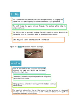 Future Trends In Pain Control | DOCX