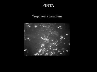 Endemic treponematoses | PPTX
