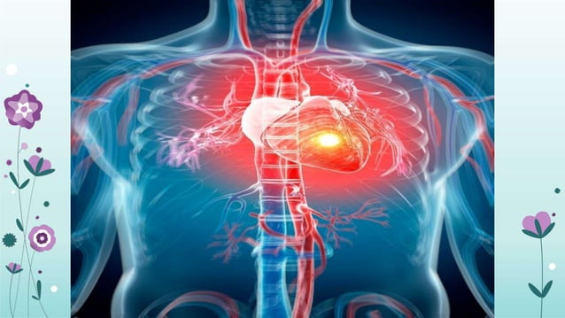 endocarditis pericarditis myocarditis | PDF | Heart and Cardiovascular ...