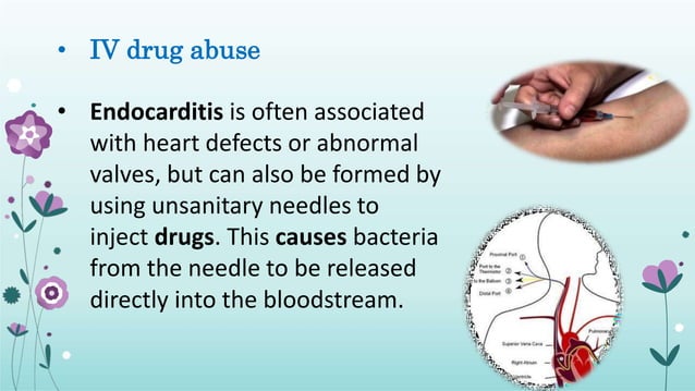 endocarditis pericarditis myocarditis | PDF | Heart and Cardiovascular ...