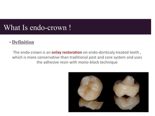Endo crown | PPTX