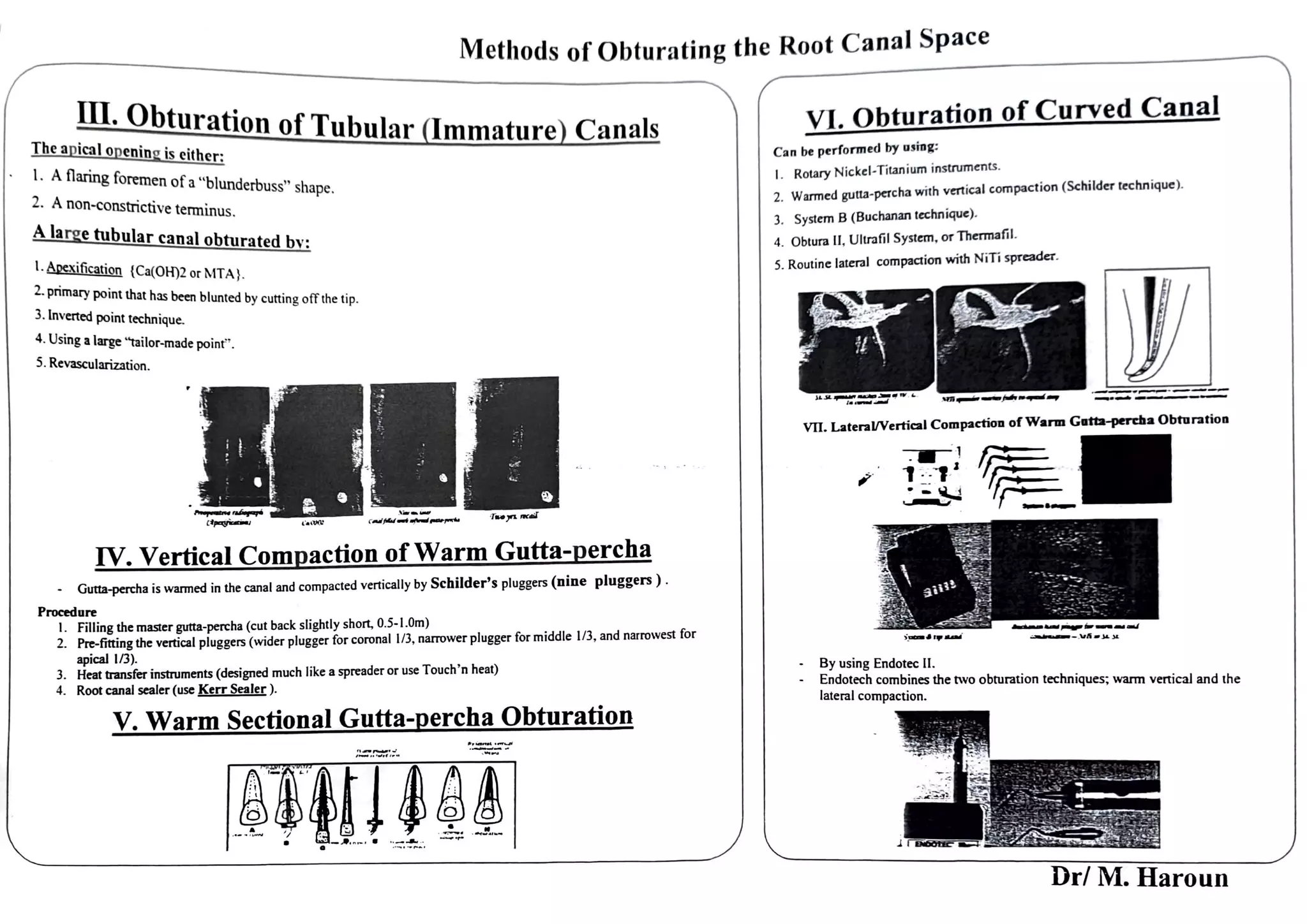 Endo - Obturation.pdf