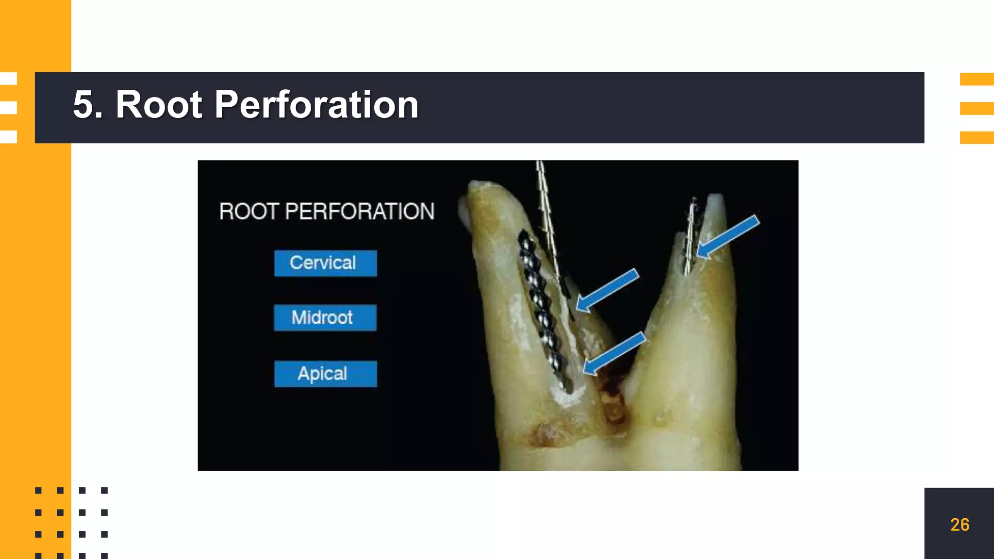 Endo Perio Lesions | PPTX